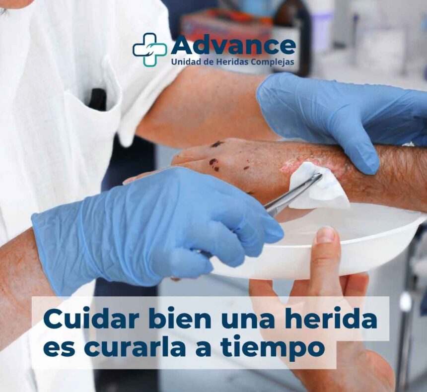 Cuándo pedir cita con un especialista en heridas complejas